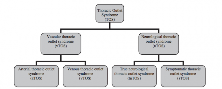 Thoracic Outlet Syndrome - Ryde Natural Health Clinic